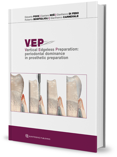 VEP. VERTICAL EDGELESS PREPARATION: PERIODONTAL DOMINANCE IN PROSTHETIC ...